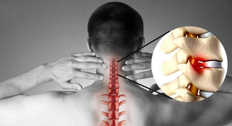 Understanding the Link Between Cervical Spondylitis and Blurred Vision